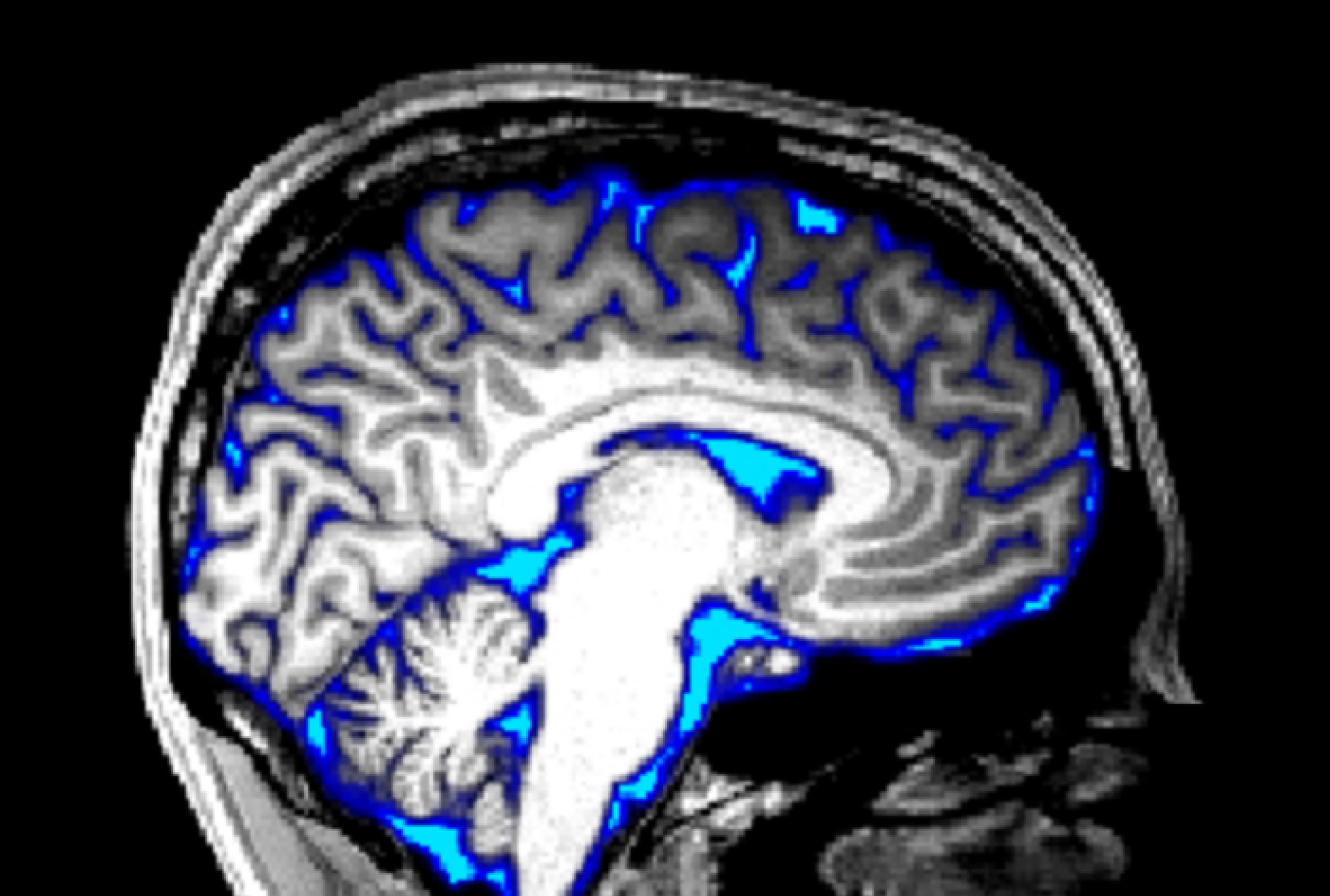 Fluid flow in the brain can be manipulated by sensory stimulation ...