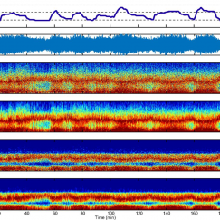 Emery N. Brown | Picower Institute