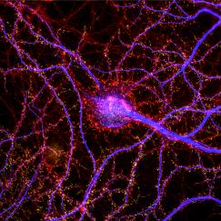 How brain cells pick which connections to keep | Picower Institute
