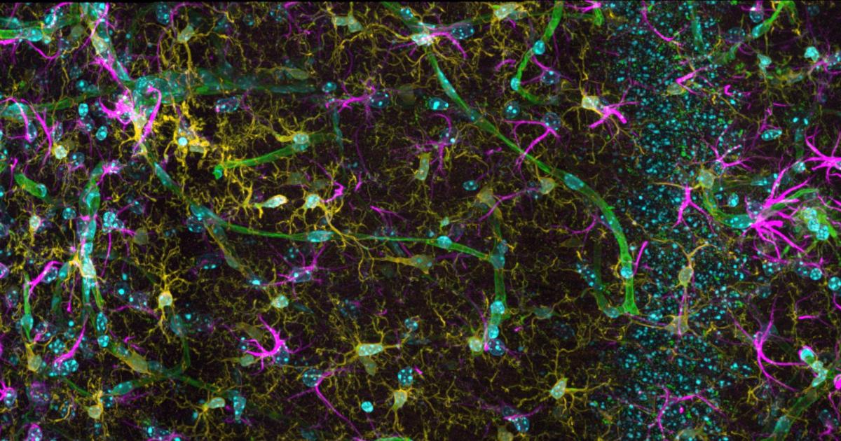 Discoveries | Picower Institute