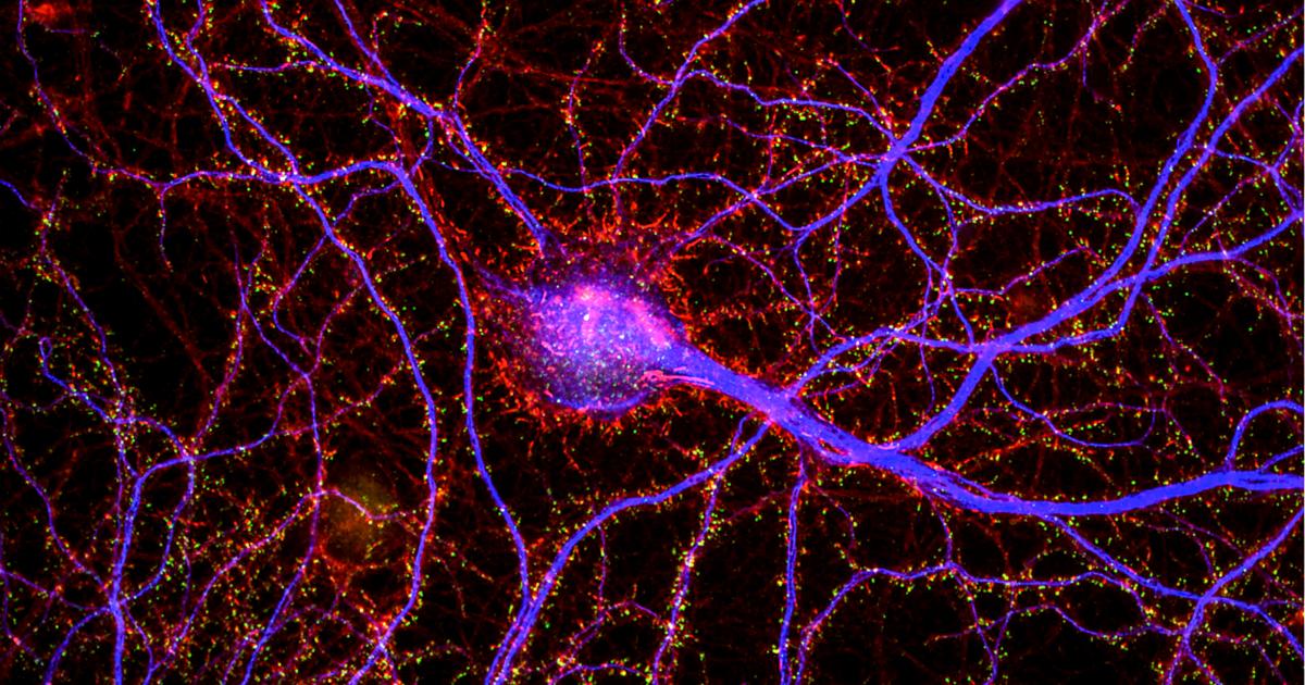 Dendrites: Molecules, Structure, and Function | Picower Institute